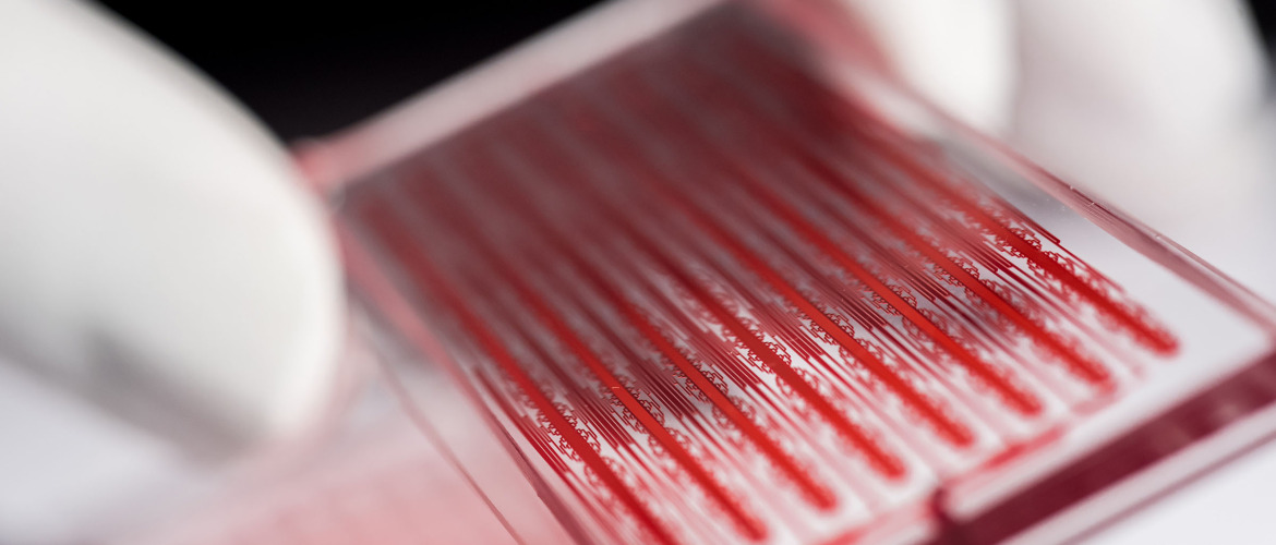 Biomedical Microsystems Laboratory – Prof. Fatih Sarioglu's Research ...